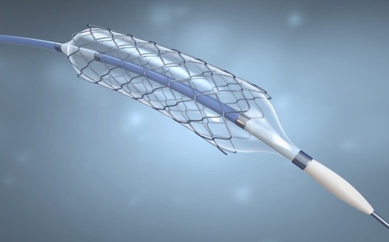 Heart Attack | Coronary Angioplasty Procedure | Stent Implantation ...