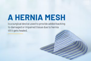 Advancing Hernia Repair: Understanding the Role of Mesh | Add More to Lives